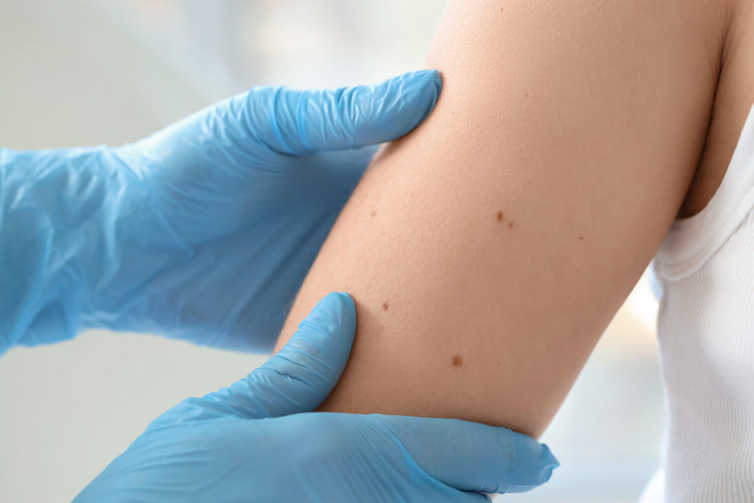 Skin Lymphoma - AboutSkin Dermatology and DermSurgery, PC. - Denver ...