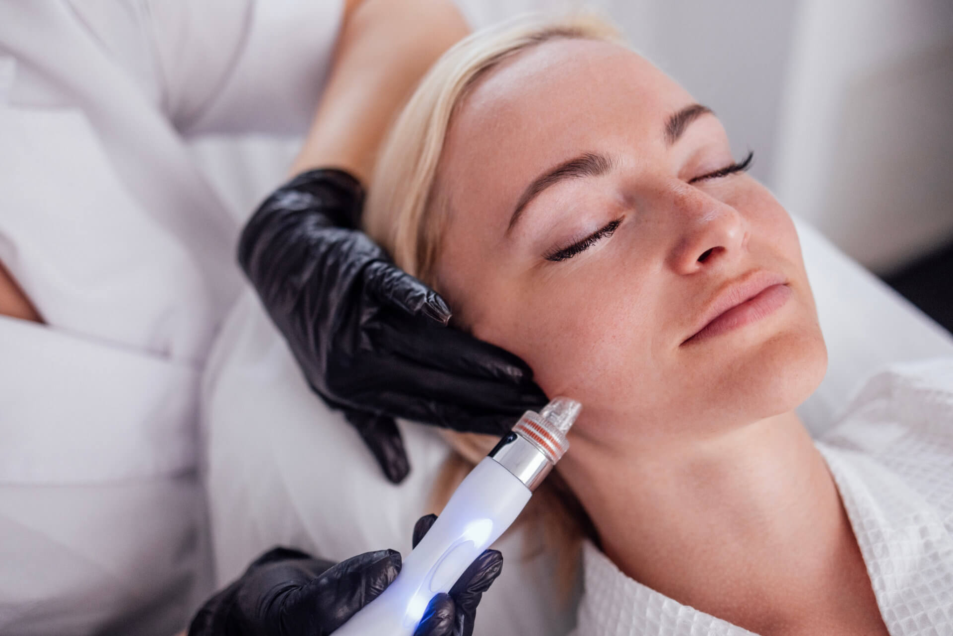 Full-Field Erbium Laser Treatment AboutSkin Dermatology and DermSurgery ...